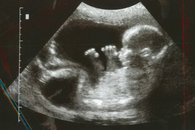 Mother leaves her fetus dead on the beach – THAT IS A CRIME ...